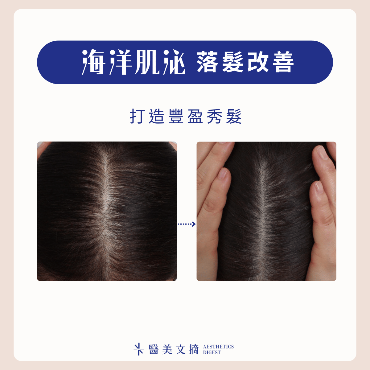 2025 革命性保養全能之選！「海洋肌泌 EXOCEAN」讓你重拾透潤嫩白年輕肌 - 醫美文摘